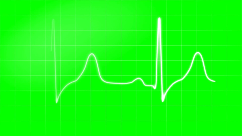 heart pulse monitor ecg on green Stock Footage Video (100% Royalty-free ...