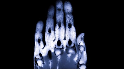 Mri Scan Hand Fingers Various Angles Stock Footage Video (100% Royalty ...