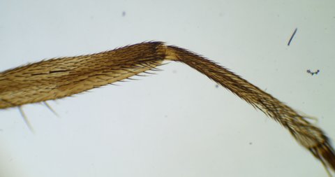 Housefly Leg Under Microscope Musca Leg Stock Footage Video (100% ...