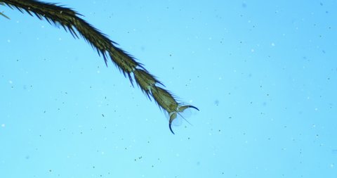 Leg Fly Under Microscope Floating Bacteria Stock Footage Video (100% ...