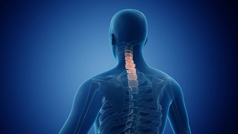 Neck Pain Anatomical 3d Animation Stock Footage Video (100% Royalty ...