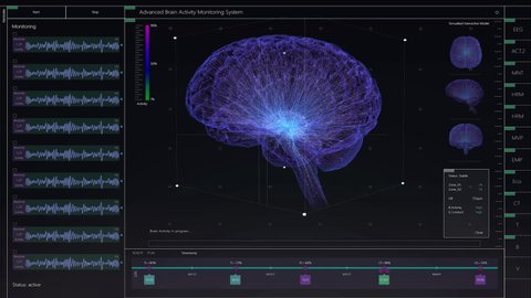 Brain Activity Monitoring System Mockup Multiple Stock Footage Video ...