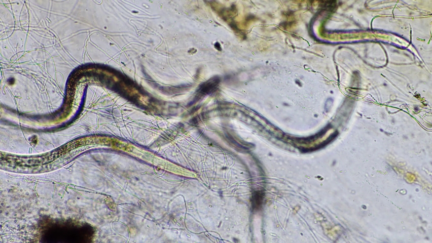 1,388 Nematodes Stock Video Footage - 4K and HD Video Clips | Shutterstock