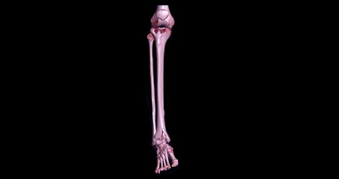 Ct Scan Leg Diagnosis Bone Fracture Stock Footage Video (100% Royalty ...