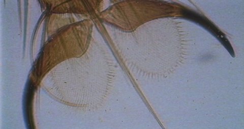 Palm Housefly Under Microscope Documentary Vhs Stock Footage Video (100 ...
