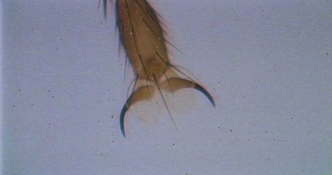 Insect Under Microscope Microscopic Documentary Vhs Stock Footage Video ...