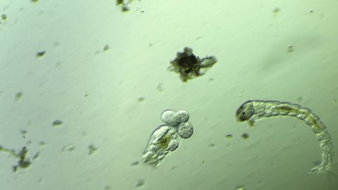 Rotifer Under Optical Microscope Magnification 100x Stock Footage Video ...