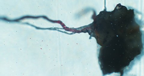 Horror Bacteria Large Dark Veins Under Stock Footage Video (100% ...