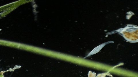 Unicellular Ciliates Litonotus Under Optical Microscope Stock Footage ...