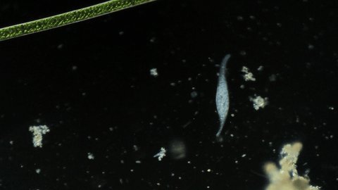 Unicellular Ciliates Litonotus Under Optical Microscope Stock Footage ...