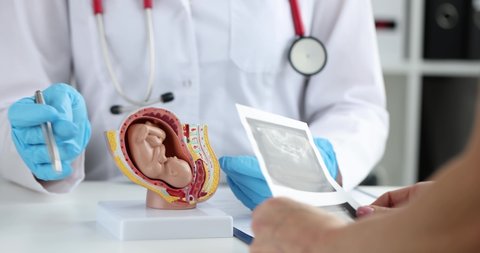 Gynecological Examination Model Uterus Fetus Child Stock Footage Video ...