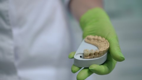Closeup Teeth Sample Model Hand Professional Stock Footage Video (100% ...