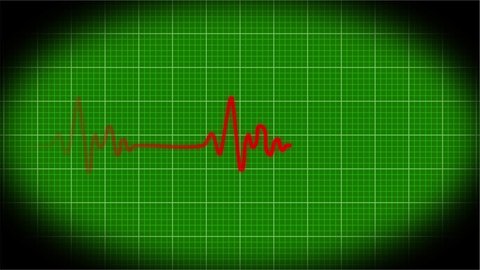 Health Ecg Heart Beat Line Simulation Stock Footage Video (100% Royalty ...