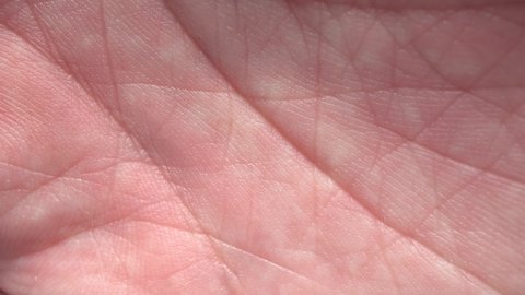 Dents On Human Skin Slider Shot Stock Footage Video (100% Royalty-free ...