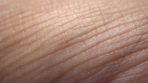 Macro Dents On Human Skin Slider Stock Footage Video (100% Royalty-free ...