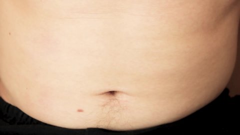 Man Belly Fat Folds Fat Subcutaneous Stock Footage Video (100% Royalty ...