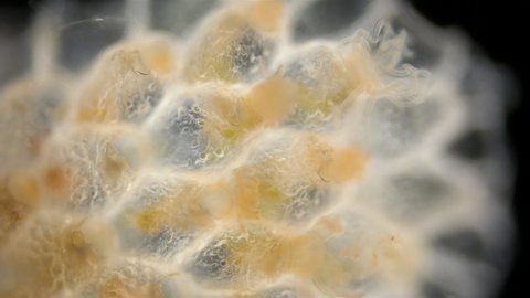 Colony Bryozoans Class Gymnolaemata Under Microscope Stock Footage ...