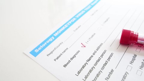 Tube Positive Monkeytox Test Blood On Stock Footage Video (100% Royalty ...