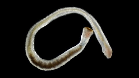 Wormlike Mollusca Under Microscope Class Solenogastres Stock Footage ...