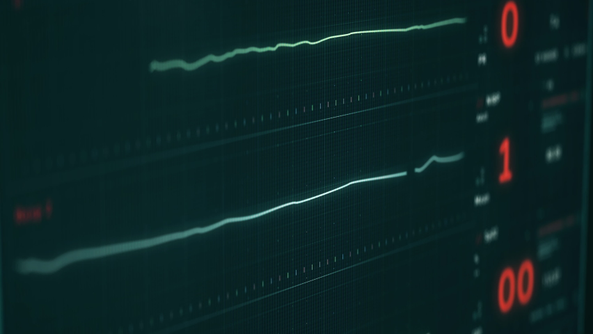 Ecg Monitor Videos: 4K and HD Video Clips