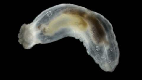 Sea Cucumber Chirodota Under Microscope Class Stock Footage Video (100% ...