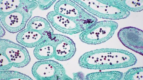 Apical Bud Filmed Under Microscope 100x Stock Footage Video (100% ...