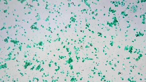 Chlamydomonas Whole Mount 200x Under Microscope Stock Footage Video ...