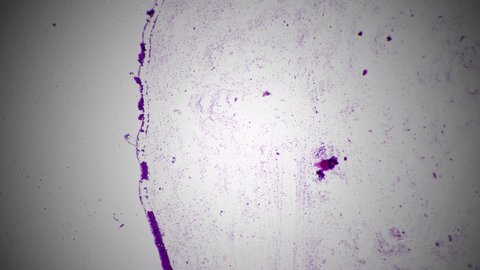 Three Types Bacteria Filmed Under Microscope Stock Footage Video (100% ...