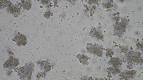 Yogurt Under Microscope Looking Lactobacillus Bacteria Stock Footage ...