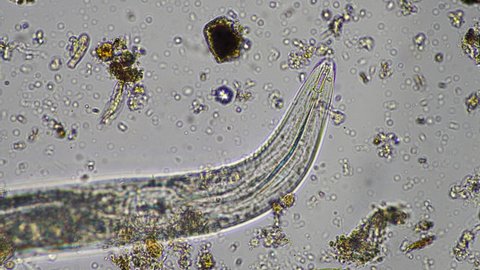 Bugs Under Microscope Microscopic Insects Worms Stock Footage Video ...