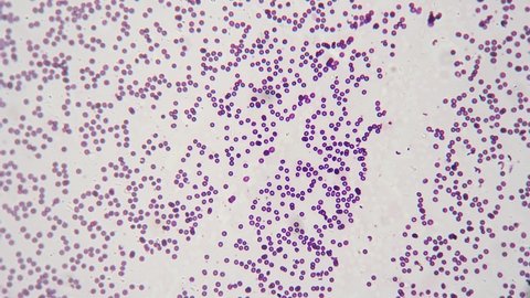 Smear Human Blood Under Microscope 200 Stock Footage Video (100% ...