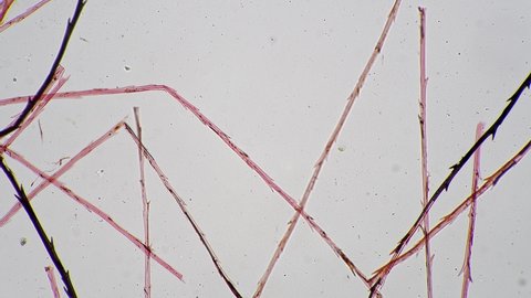 Dandelion Fuzz Whole Mount Magnified Under Stock Footage Video (100% ...