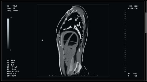 Xray Scan By Modern Medical Radiology Stock Footage Video (100% Royalty ...