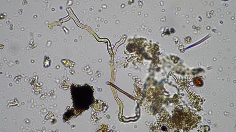 Soil Microorganisms Under Microscope Soil Life Stock Footage Video (100 ...
