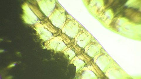 Worm Under Microscope Clitellate Oligochaete Worms Stock Footage Video ...