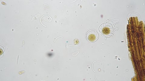 Spore Equisetum Arvense Whole Mount Under Stock Footage Video (100% ...