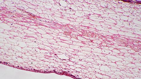 Polliondium Funaria Longitudinal Section Under Microscope Stock Footage ...