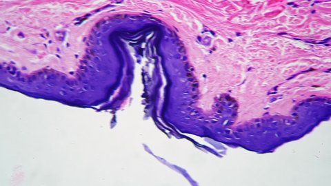 Microscope Image Human Skin Sweat Glands Stock Footage Video (100% ...