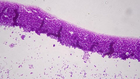 Three Types Bacteria Filmed Under Microscope Stock Footage Video (100% ...