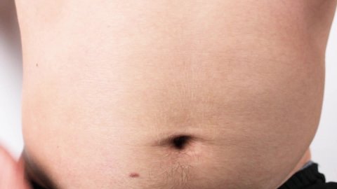 Man Belly Fat Folds Fat Subcutaneous Stock Footage Video (100% Royalty ...