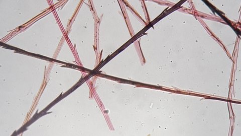 Dandelion Fuzz Whole Mount Magnified Under Stock Footage Video (100% ...