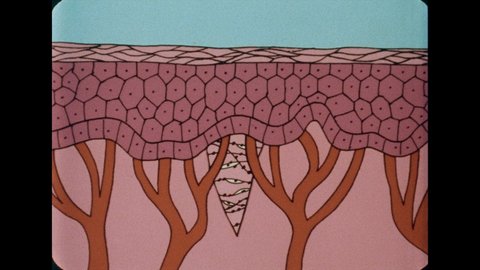 1990s Animation Illustration Dermis Postwound Healing Stock Footage ...