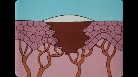 1990s Animation Microscopic Illustration Skin Blister Stock Footage ...