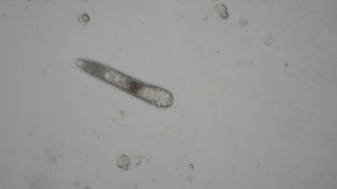 Demodex Facial Mites Under Microscope Stock Footage Video (100% Royalty ...