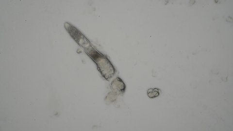 Demodex Facial Mites Under Microscope Stock Footage Video (100% Royalty ...