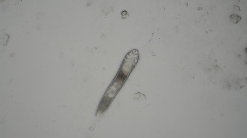 Demodex Facial Mites Under Microscope Stock Footage Video (100% Royalty ...