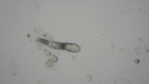 Demodex Facial Mites Under Microscope Stock Footage Video (100% Royalty ...