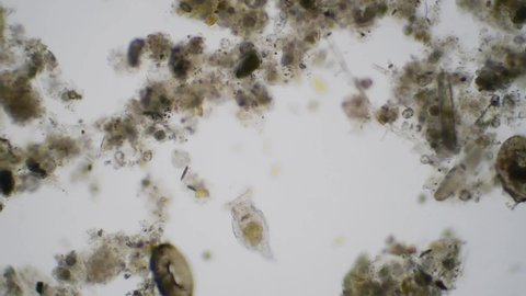 Aquatic Microorganisms Observed Under Microscope Stock Footage Video ...
