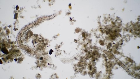Aquatic Microorganisms Observed Under Microscope Stock Footage Video ...