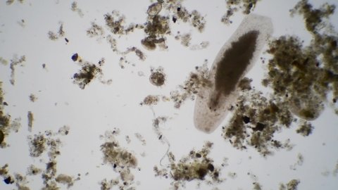 Aquatic Microorganisms Observed Under Microscope Stock Footage Video ...
